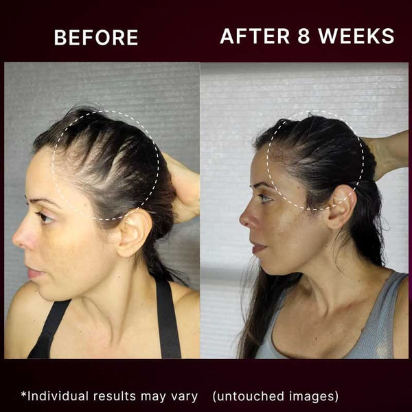 Nail n Mane: Plant-based Supplement to Support Healthy Hair and Nails ...
